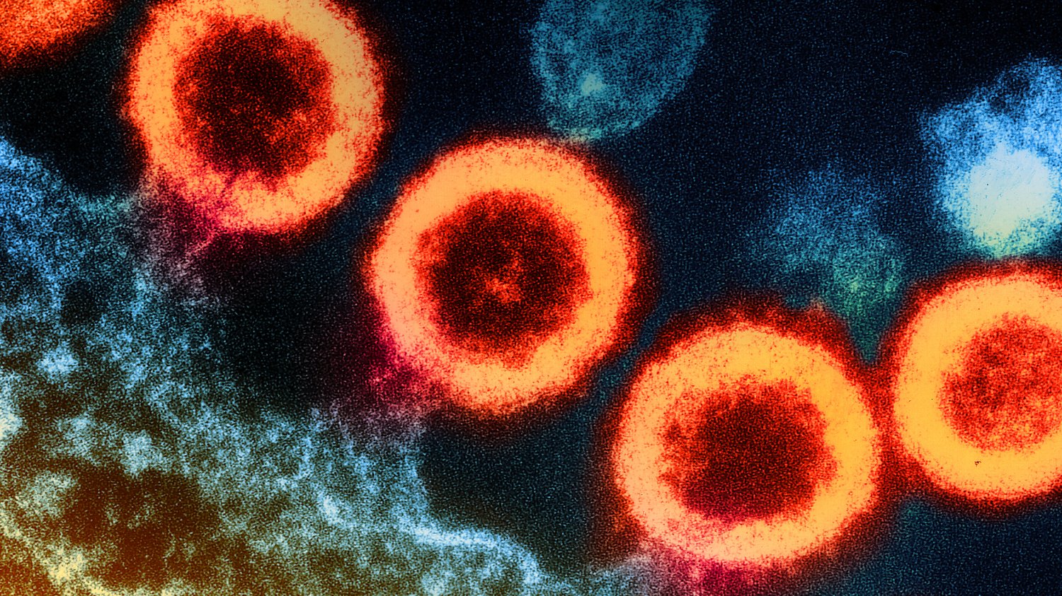 The weird and wonderful world growing spuds (and other crops) in space ...